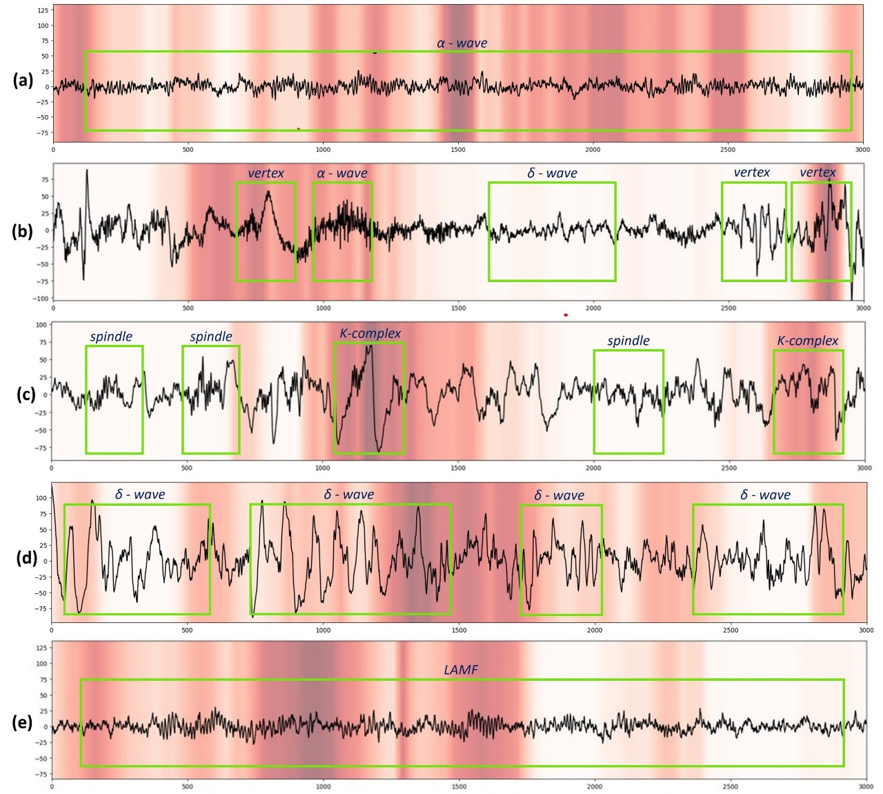 A Deep Dive into Sleep: Single-Channel EEG-Based Sleep Stage Classification with Model ...